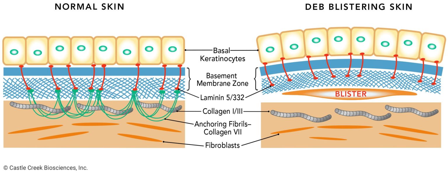 Castle Creek Biosciences: D-Fi Gene Therapy : Castle Creek Biosciences ...